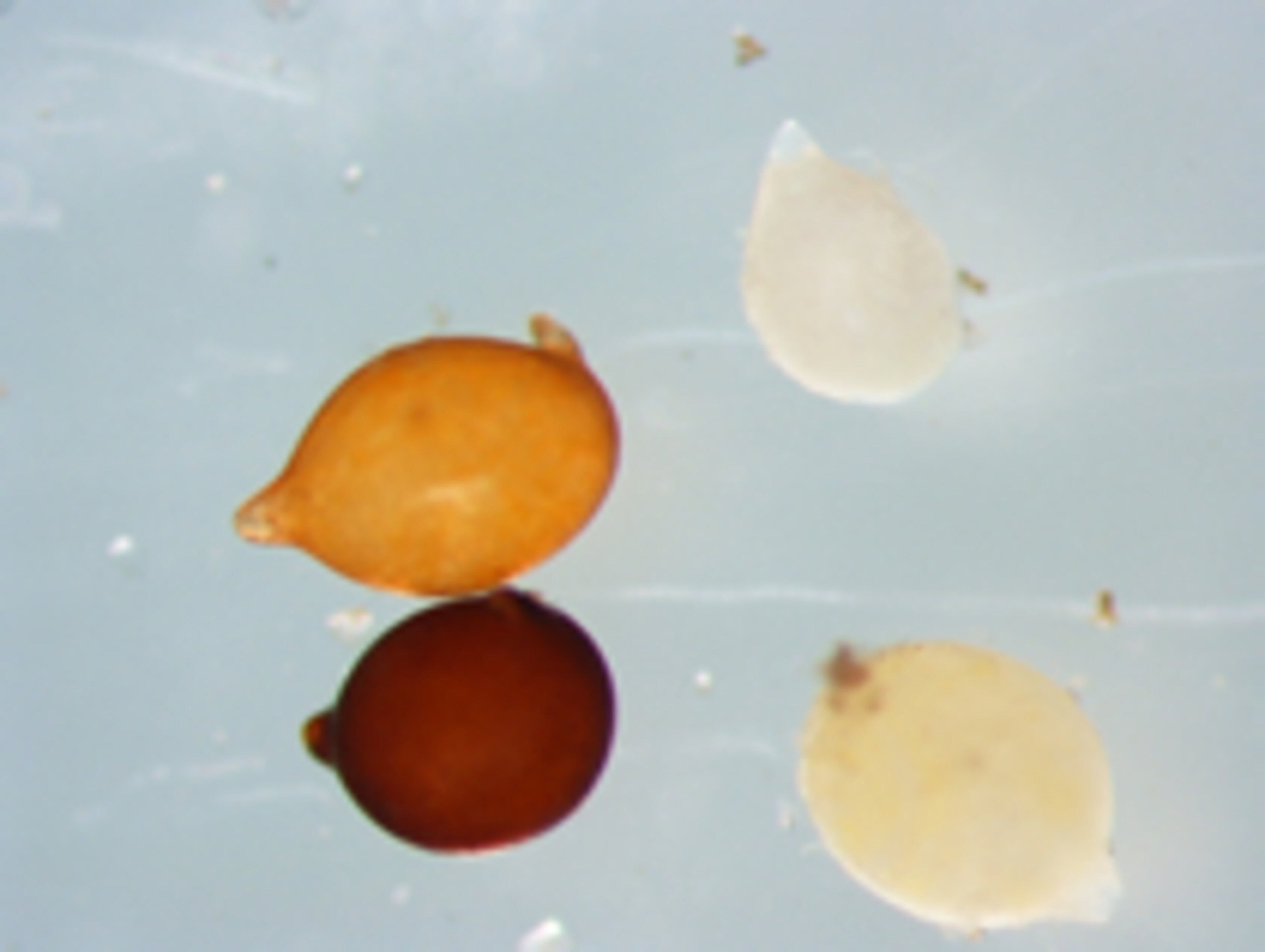 Check Fields for Soybean Cyst Nematodes | CropWatch | Nebraska